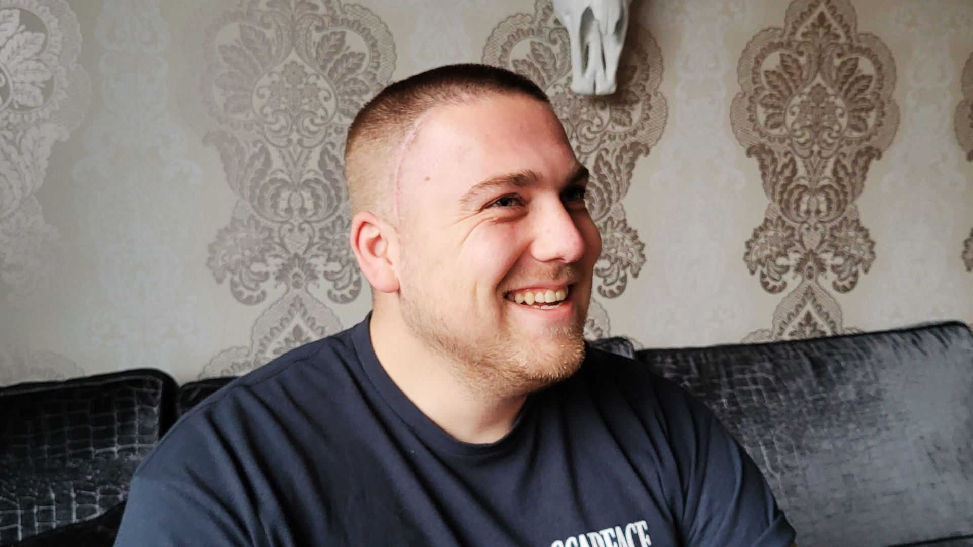 Hoe is het met Mathijs, die een hersentumor bleek te hebben en geen burn-out? - Rijnmond