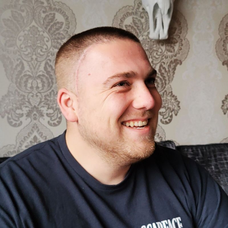 Hoe is het met Mathijs, die een hersentumor bleek te hebben en geen ...