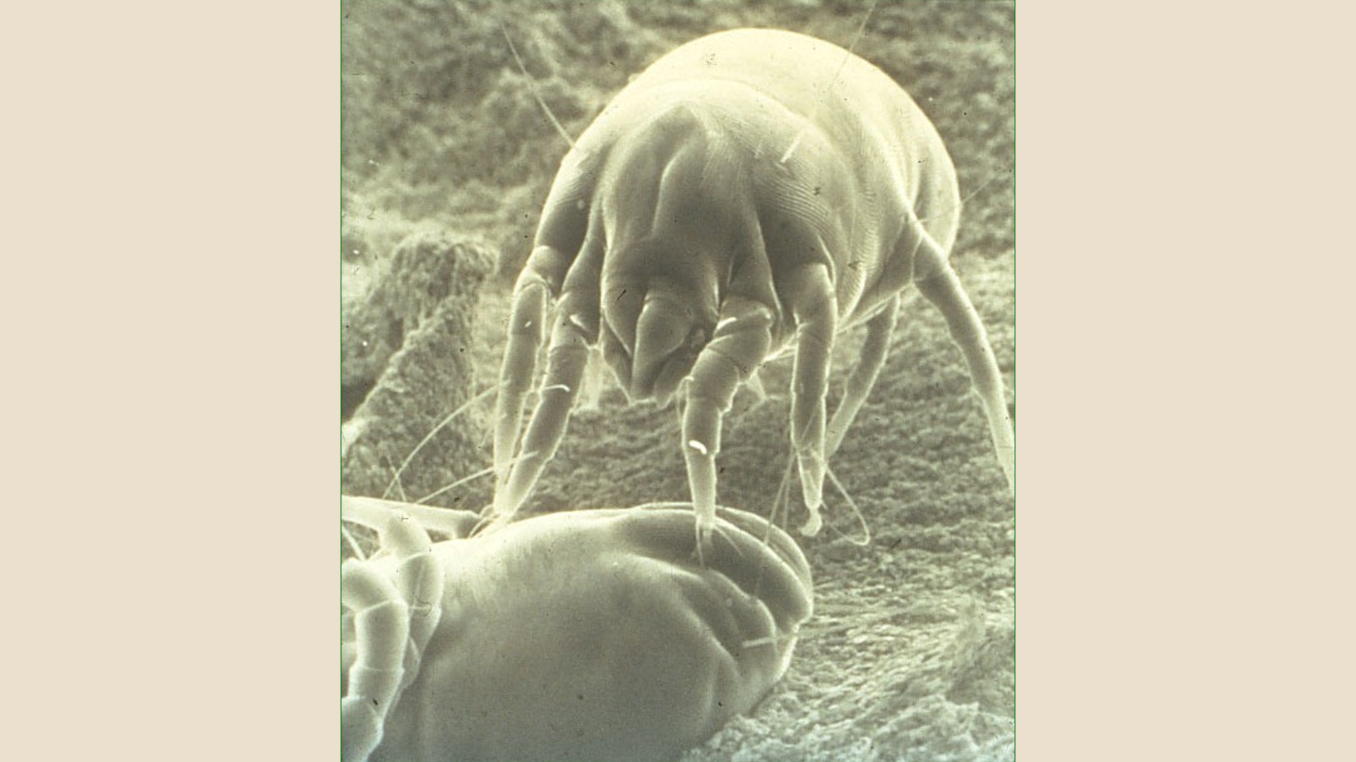 Hoe komen kleine beestjes in huis terecht? 'Huismijt hoort ook bij de ...