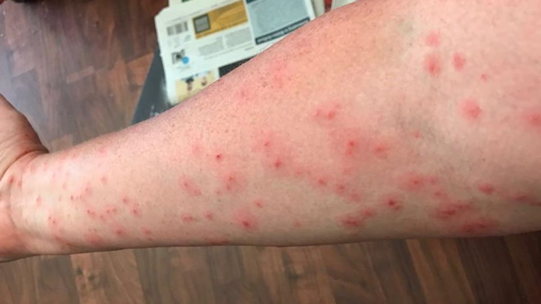 Jeuk! Wat zijn de beste tips tegen de eikenprocessierups? - Omroep Gelderland