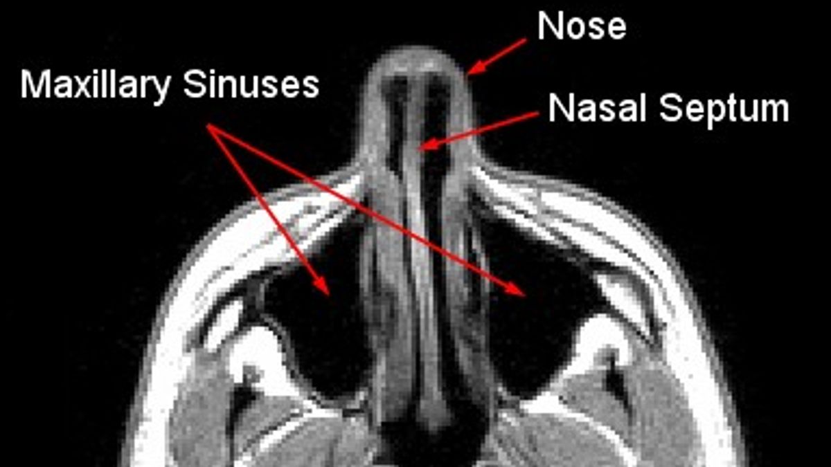 Jeuk aan je neus? - Rijnmond