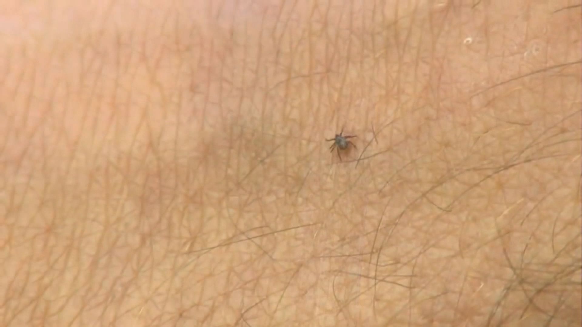 Veel tekenbeten loop je op in je eigen tuin! - Omroep Zeeland