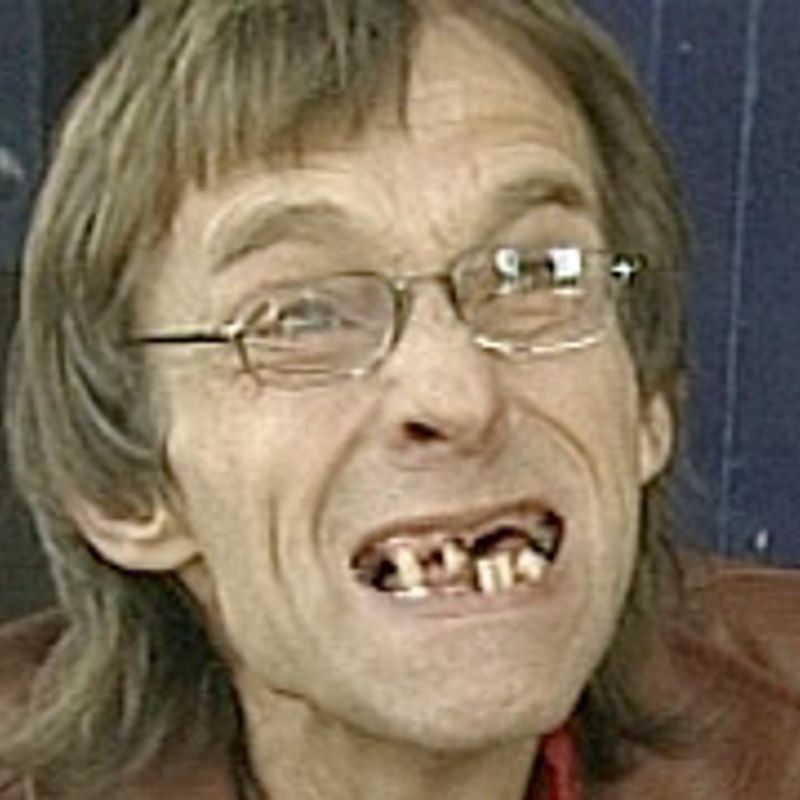 Waarom hebben we verstandskiezen? - Rijnmond