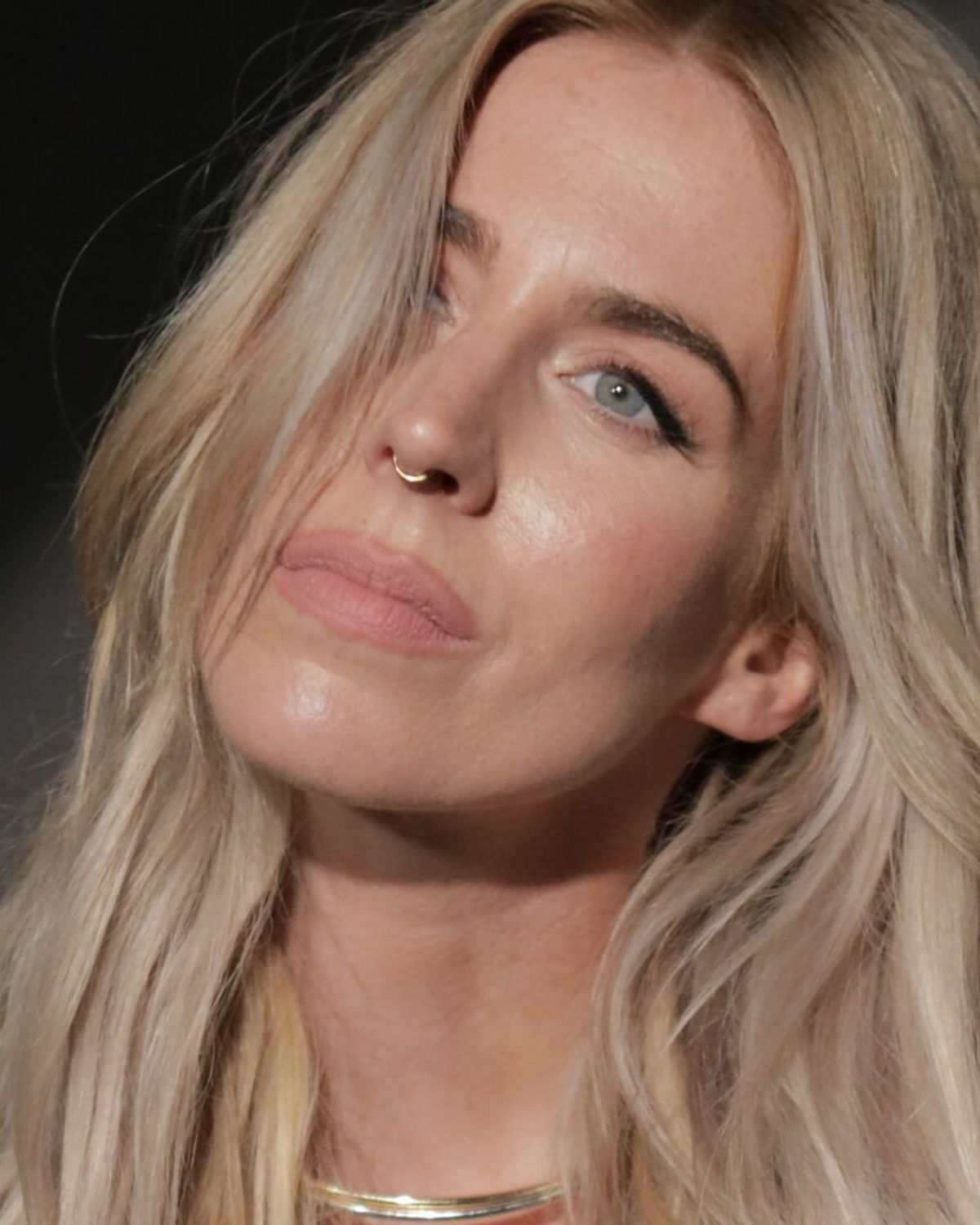 Een nachtmerrie voor zangeres Elske DeWall: aangezichtsverlamming van ...