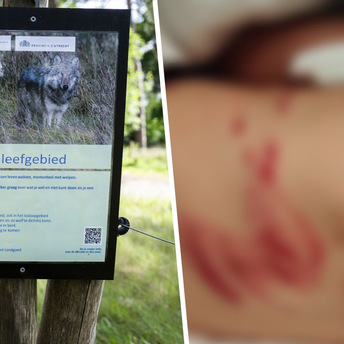 Foto's tonen bijtwonden van 'wolf' op 6-jarige na incident bij Pyramide ...