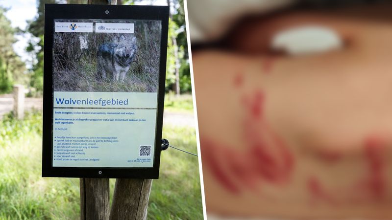 Foto's tonen bijtwonden van 'wolf' op 6-jarige na incident bij Pyramide ...