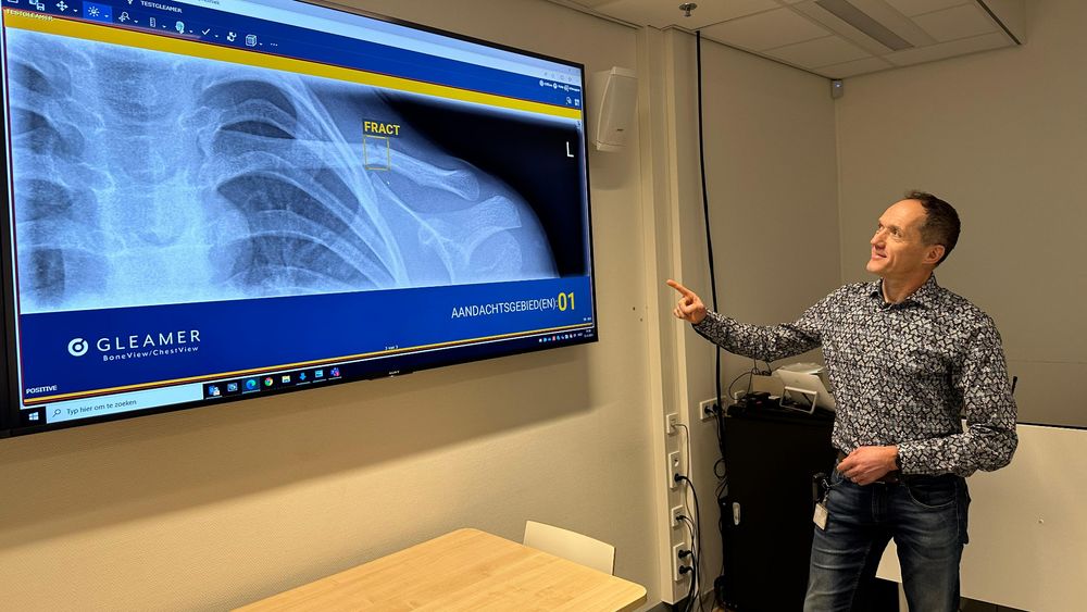 Botbreuken herkennen met AI, Meander MC is enthousiast: 'Scheelt de patiënt tijd en geld' - RTV ...