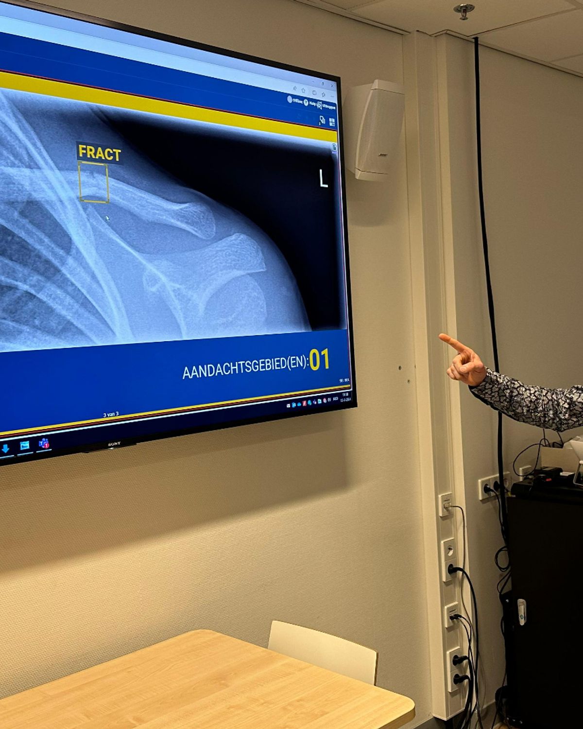 Botbreuken herkennen met AI, Meander MC is enthousiast: 'Scheelt de patiënt tijd en geld' - RTV ...