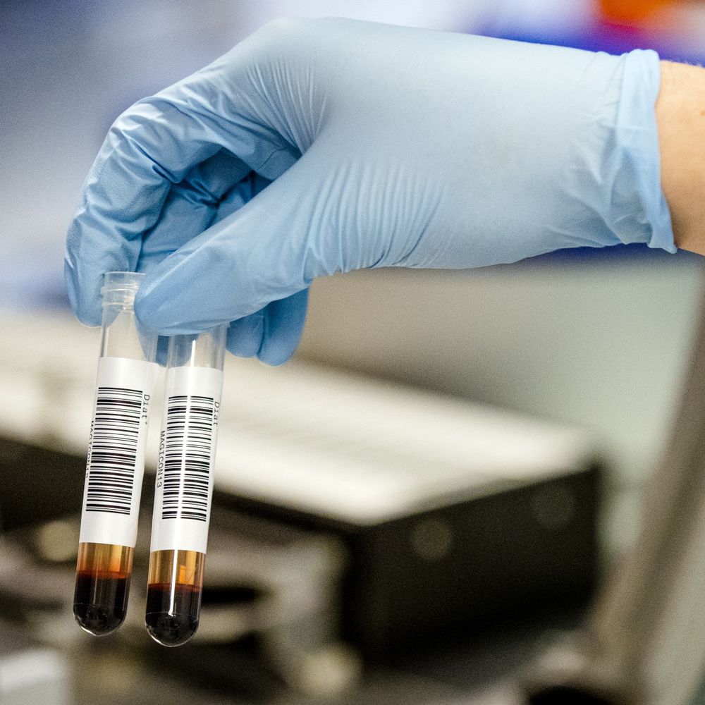 Bloedprikposten in ziekenhuizen nog altijd dicht: geen zicht op heropening - Omroep West