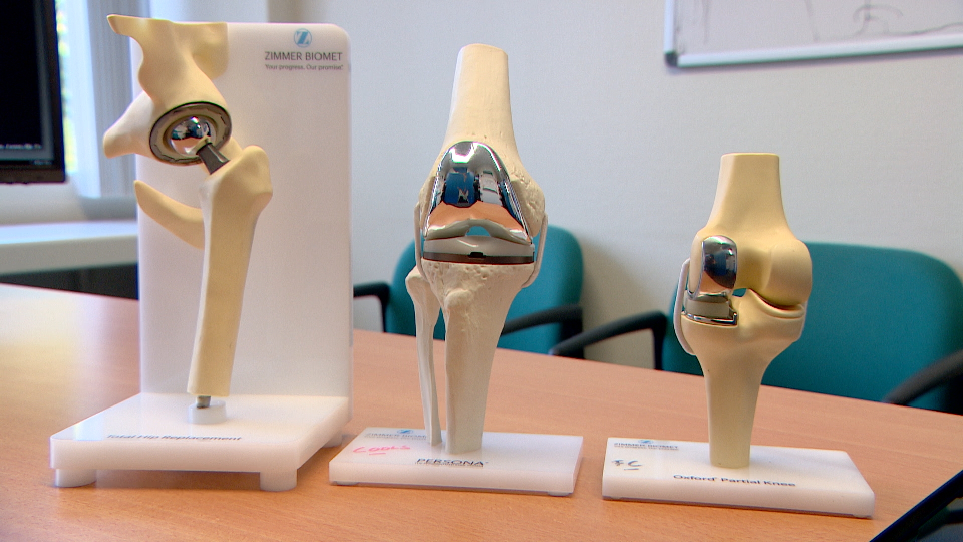 Linda is nummer 1.000 op speciale app voor nieuwe heup of knie: 'Ik ...