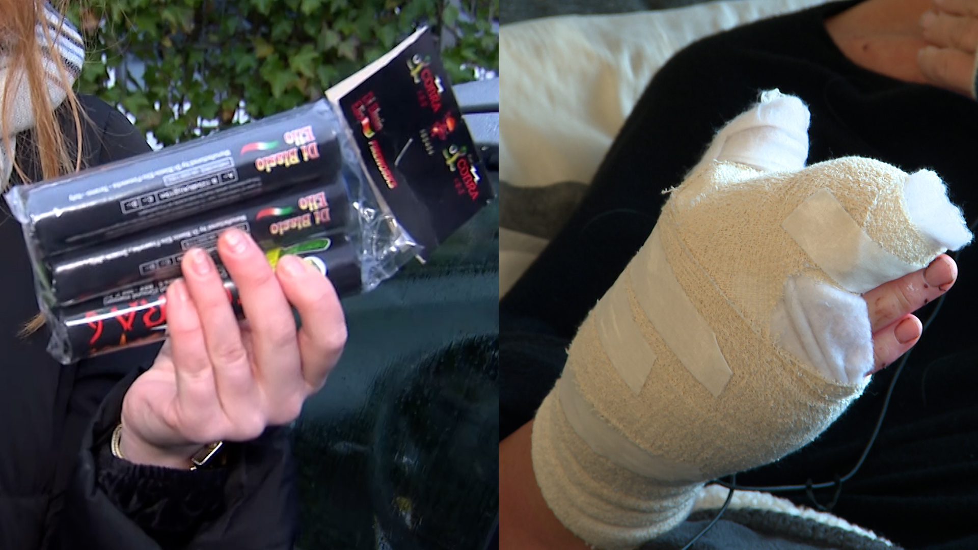 Slachtoffers illegaal vuurwerk voor het leven getekend: 'Ik mis een ...