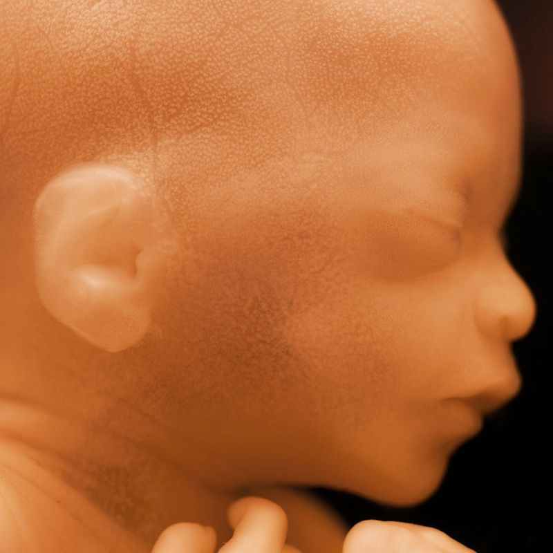 Rem op DNA-test ongeboren baby - L1 Nieuws