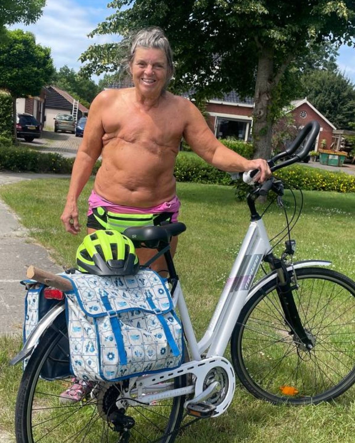 'Ik vind het heel naar hoe ik eruit zie, maar ik schaam me niet' - RTV ...